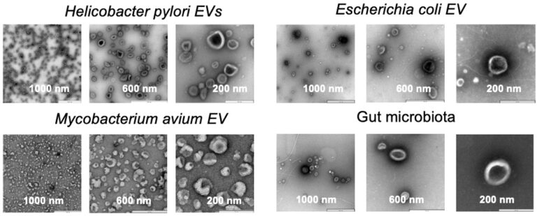Extracellular Vesicles - Exodus Bio