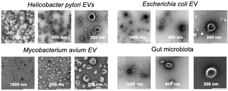 Extracellular Vesicles - Exodus Bio