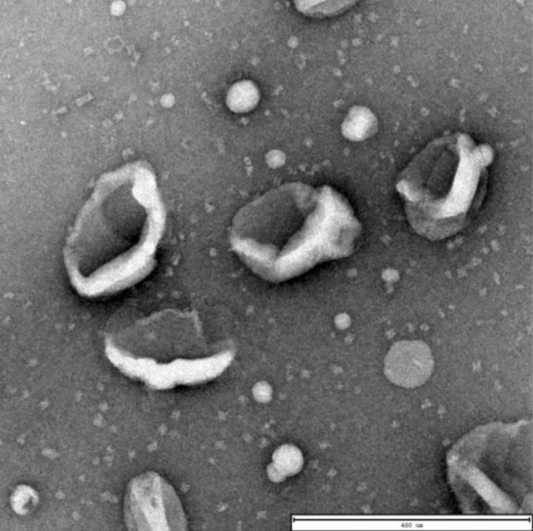 Extracellular Vesicles - Exodus Bio