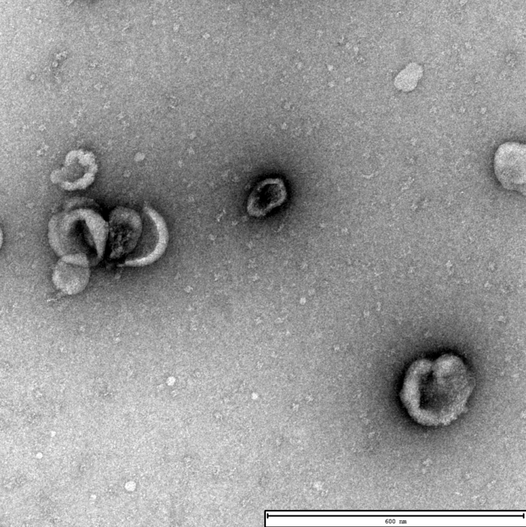 Extracellular Vesicles - Exodus Bio
