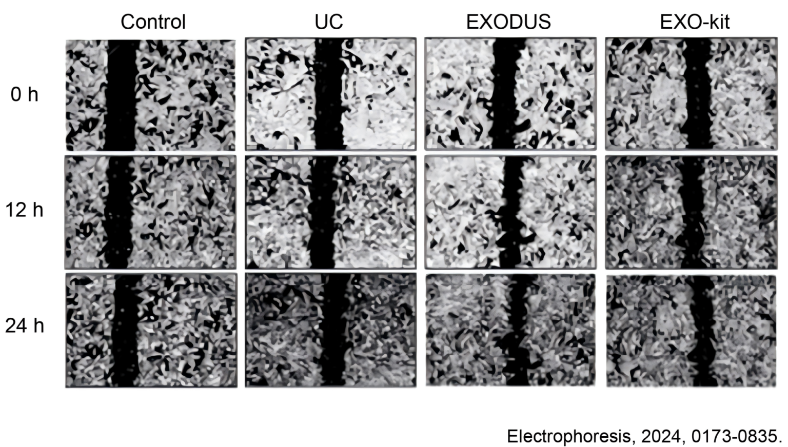 Extracellular Vesicles - Exodus Bio